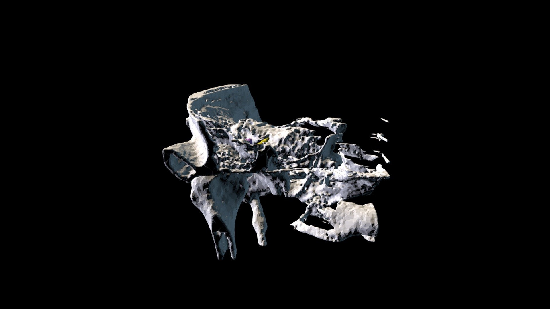 Otoplan Original w temp bone - 3D model by catseyevisuals [18d8e38 ...