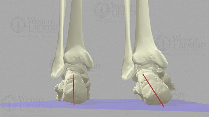 Calcaneus 3D models - Sketchfab