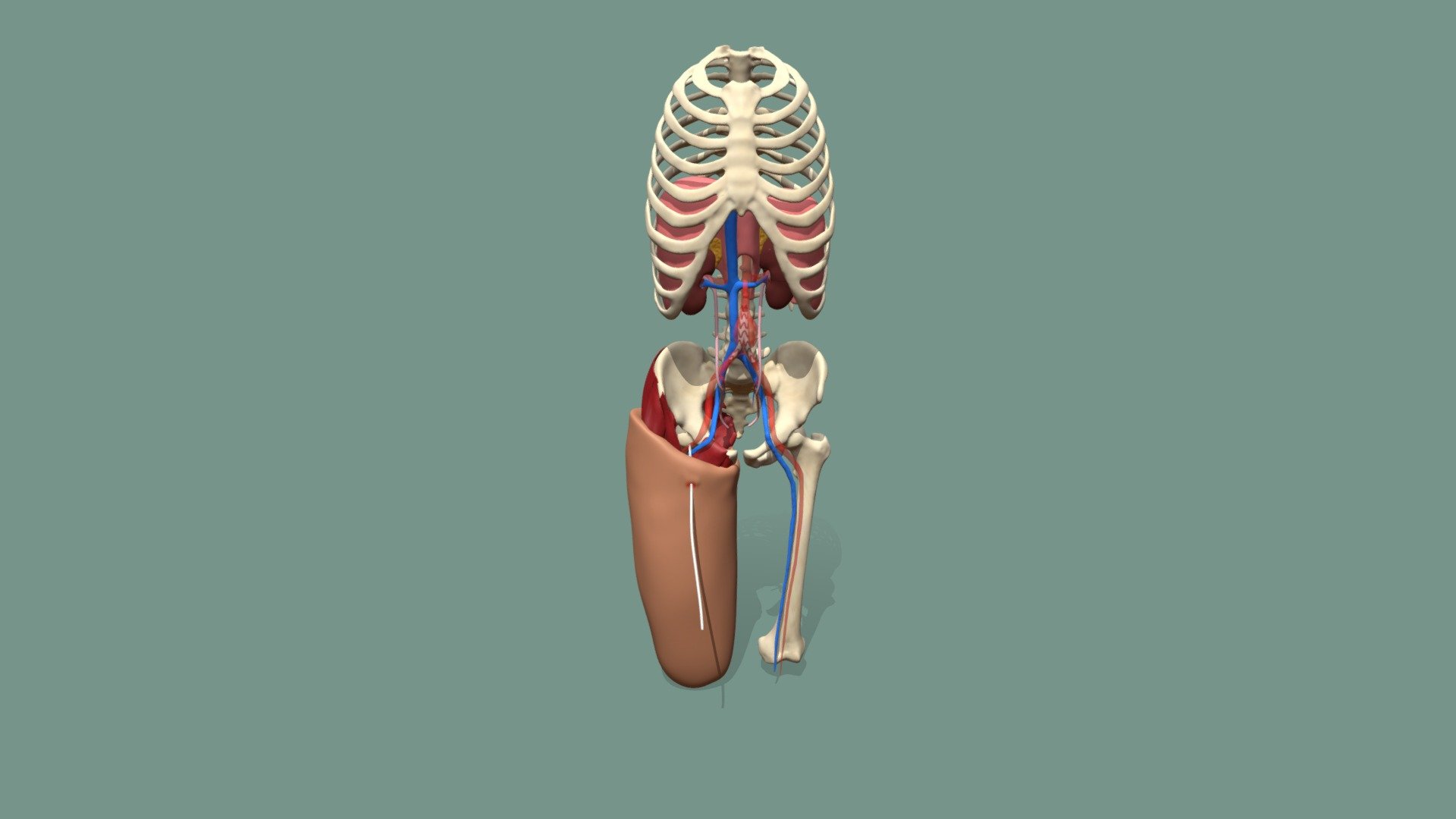 Hololens 2019-EVAR for Abdominal Aortic Aneurysm - 3D model by ...
