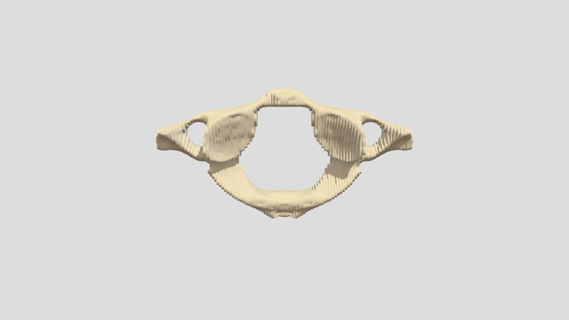 3d vertebra opcion 3 - 3D model by martirofes [1a24810] - Sketchfab