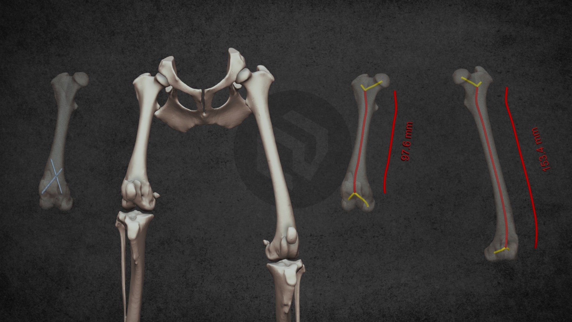 Short femur in a dog (ID5557) - 3D model by LimesVet [1a316c4] - Sketchfab
