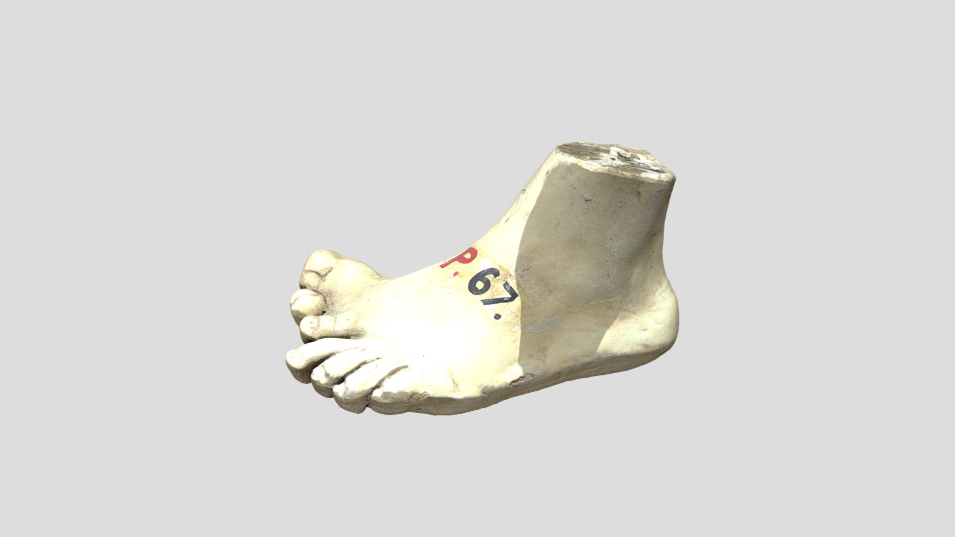 Foot Pathology - Supernumerary Toes - Download Free 3D model by UCLSOP ...