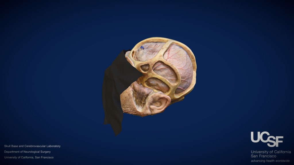 Craniometric Points - Cureus - A 3D model collection by SBCVL_UCSF ...