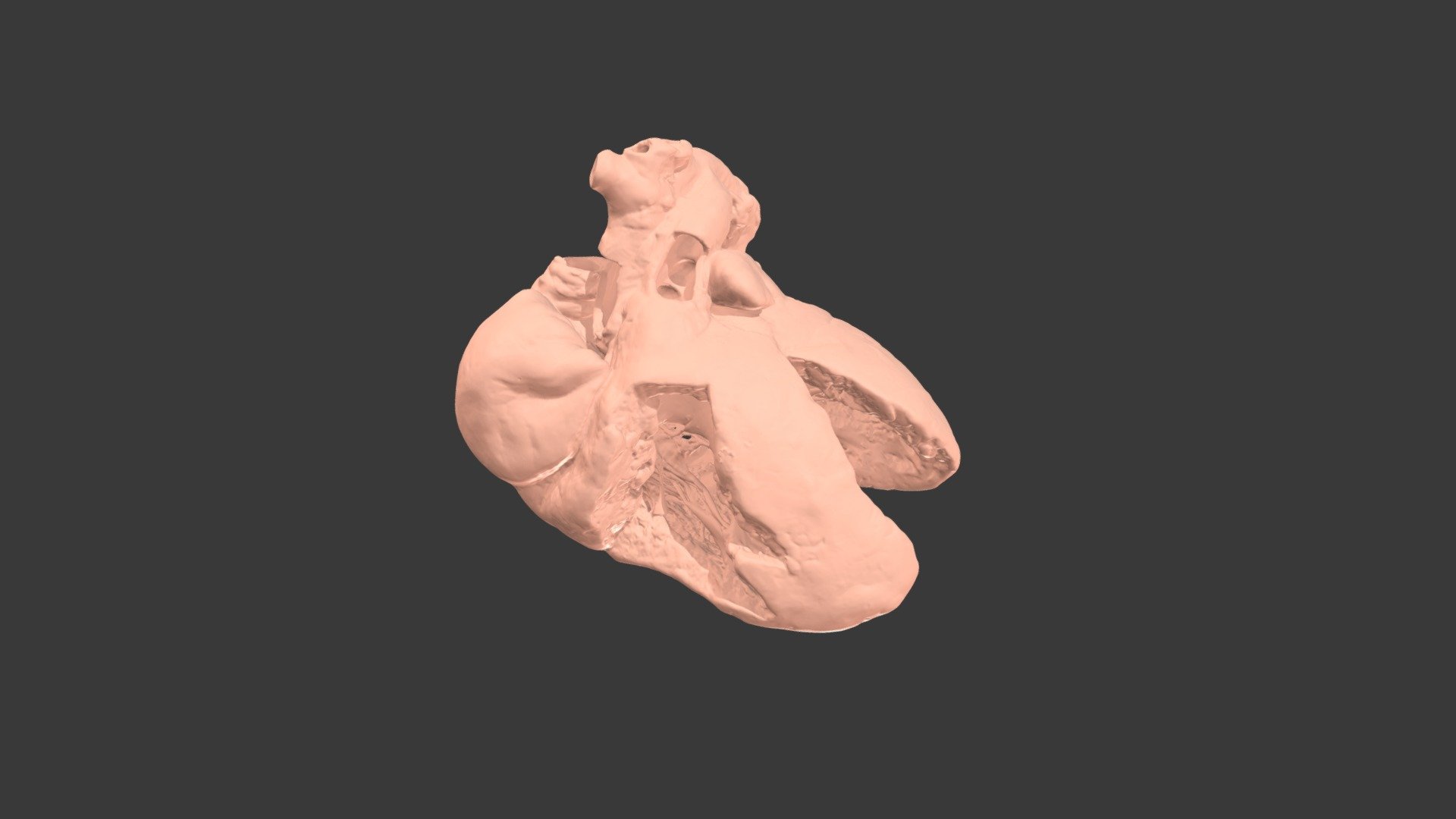 CAVC #4 - {S,D,S} with Complete CAVC (Type C) - 3D model by heartmodels ...