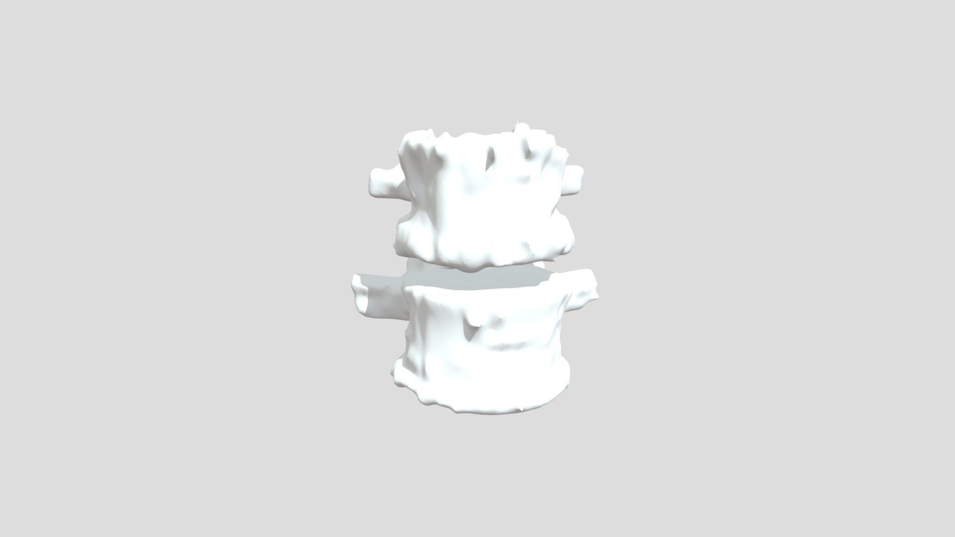 Segmentation_ Segment Lumbar Vertebrae - 3D model by mohamed.jlidi ...