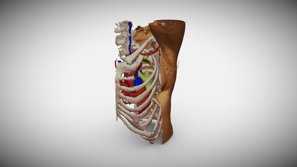 Medical - A 3D model collection by cyberdan - Sketchfab