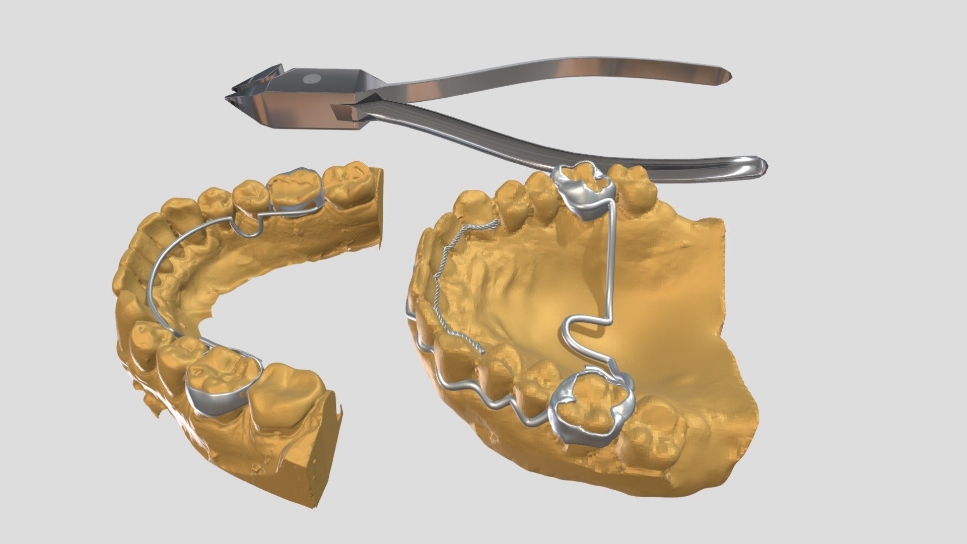 Orthodontic technology - 3D model by justericho1 [1c1fe3c] - Sketchfab