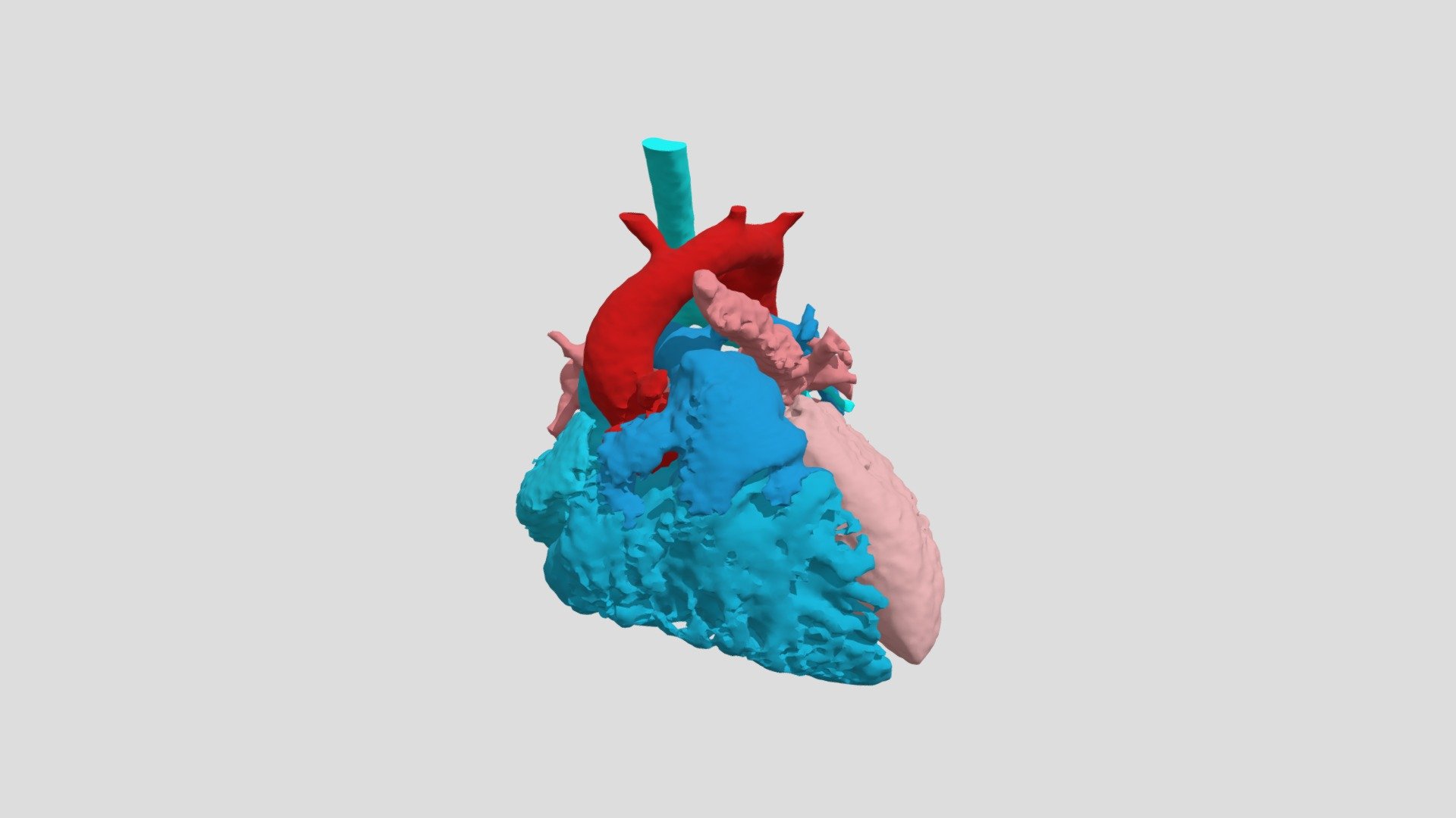 Vascular Ring (S0340) - 3D model by NCH Advanced Projects Laboratory ...