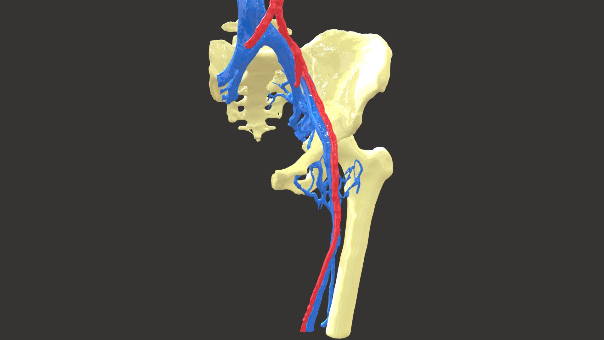 Variant of MAY-TURNER syndrom - 3D model by Chair_Digital_Anatomy ...