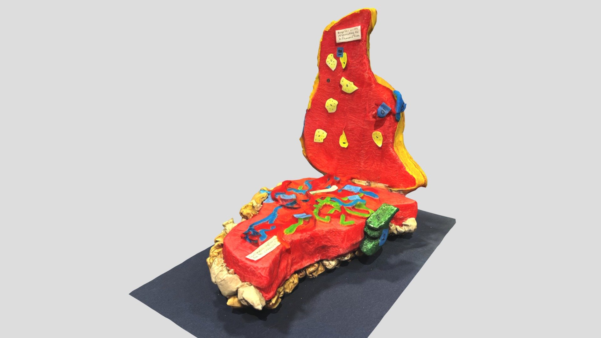 Liver Cirrhosis Interior DEC 2025 - Download Free 3D model by bcxrlab ...