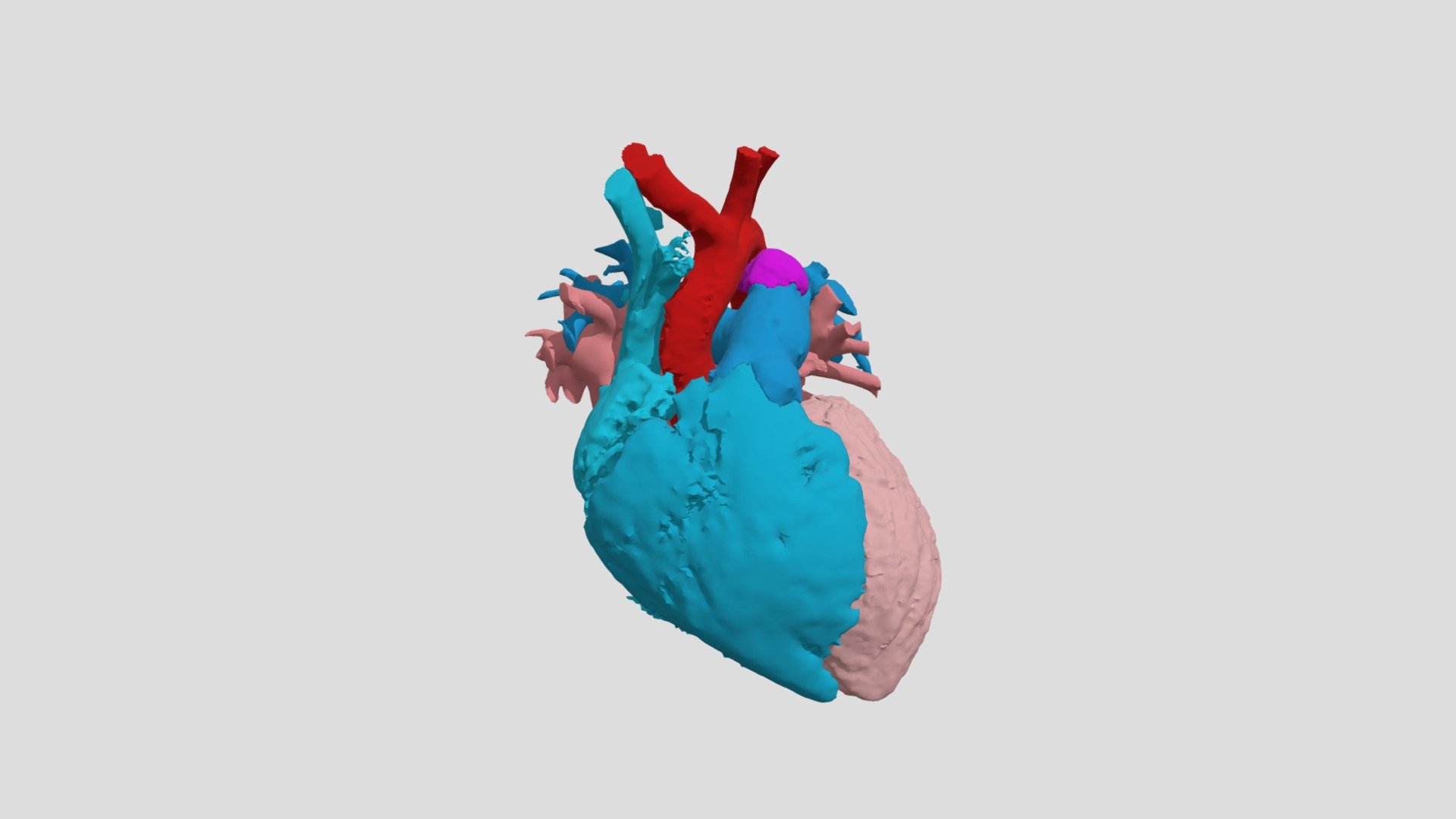 Patent Ductus Arteriosus (S0407) - 3D model by NCH Advanced Projects Laboratory (APL) [1cb64aa ...