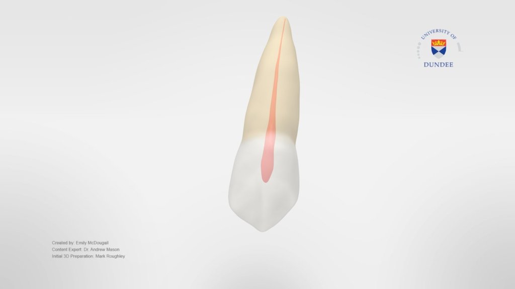 Maxillary Canine - Endodontic - 3D model by University of Dundee ...