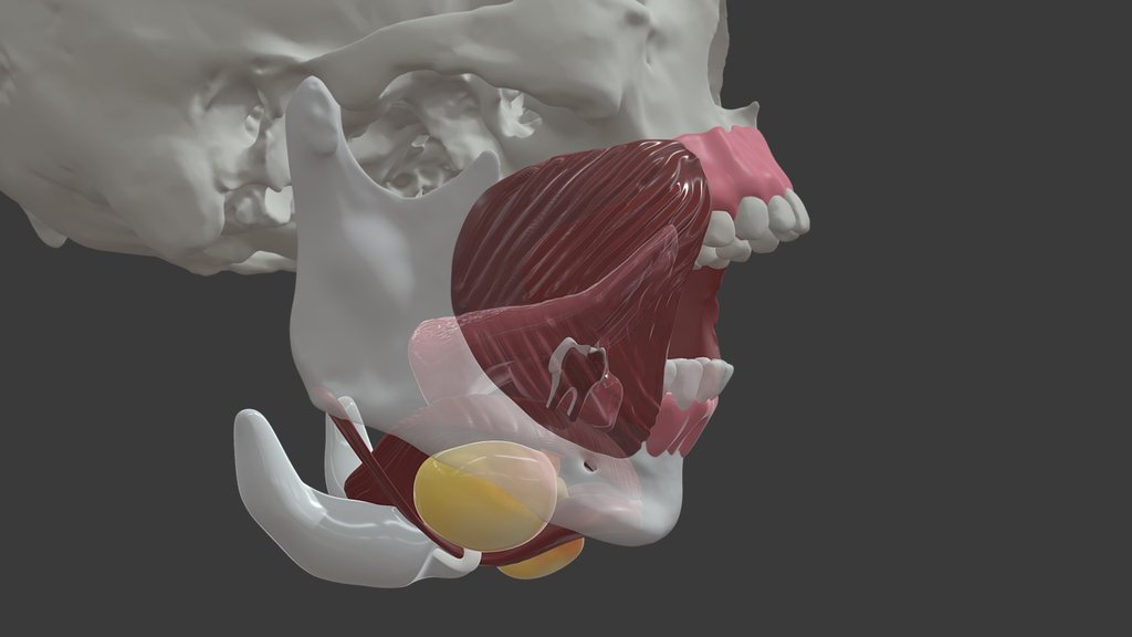 Mandibular First Molar Infection Pathway 4 - A 3D model collection by ...