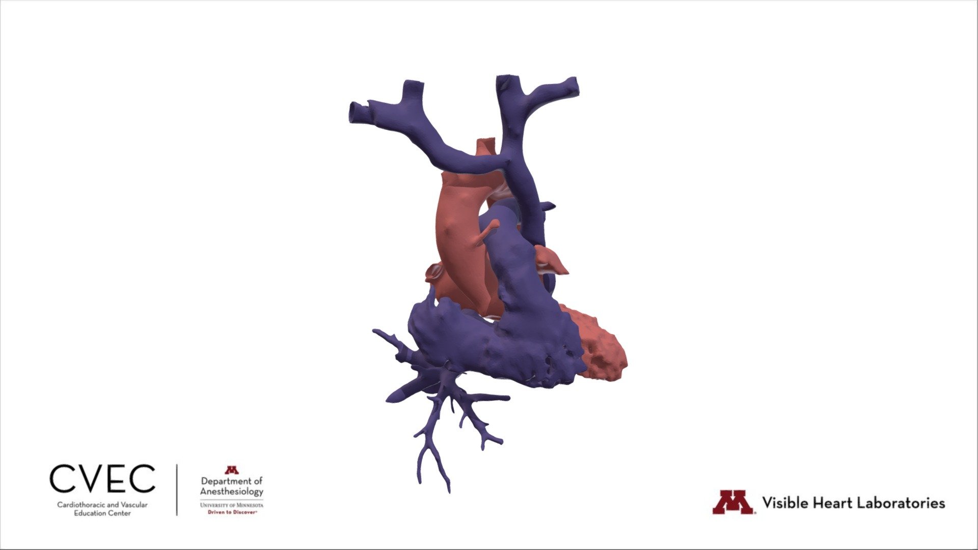 ILPSVC - 3D model by CVEC [1db35f4] - Sketchfab