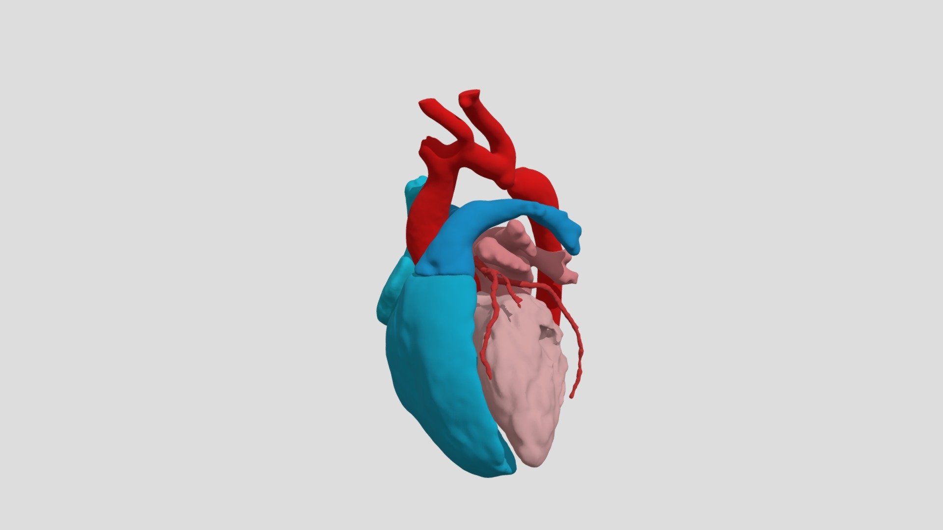 Coarctation of Aorta (S0293) - 3D model by NCHS Cardiac Advanced ...