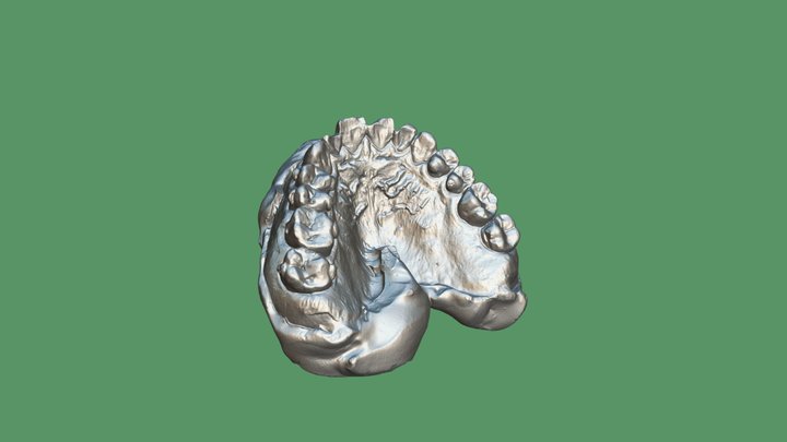 Dental-scanning 3D models - Sketchfab
