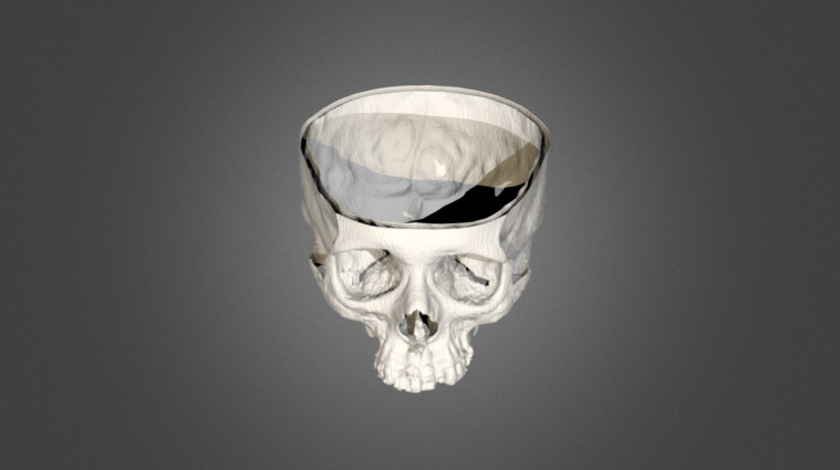 Normal Skull v0.1 - 3D model by Muhamad Ahmad (@mabuelhagag) [1dd42f4 ...
