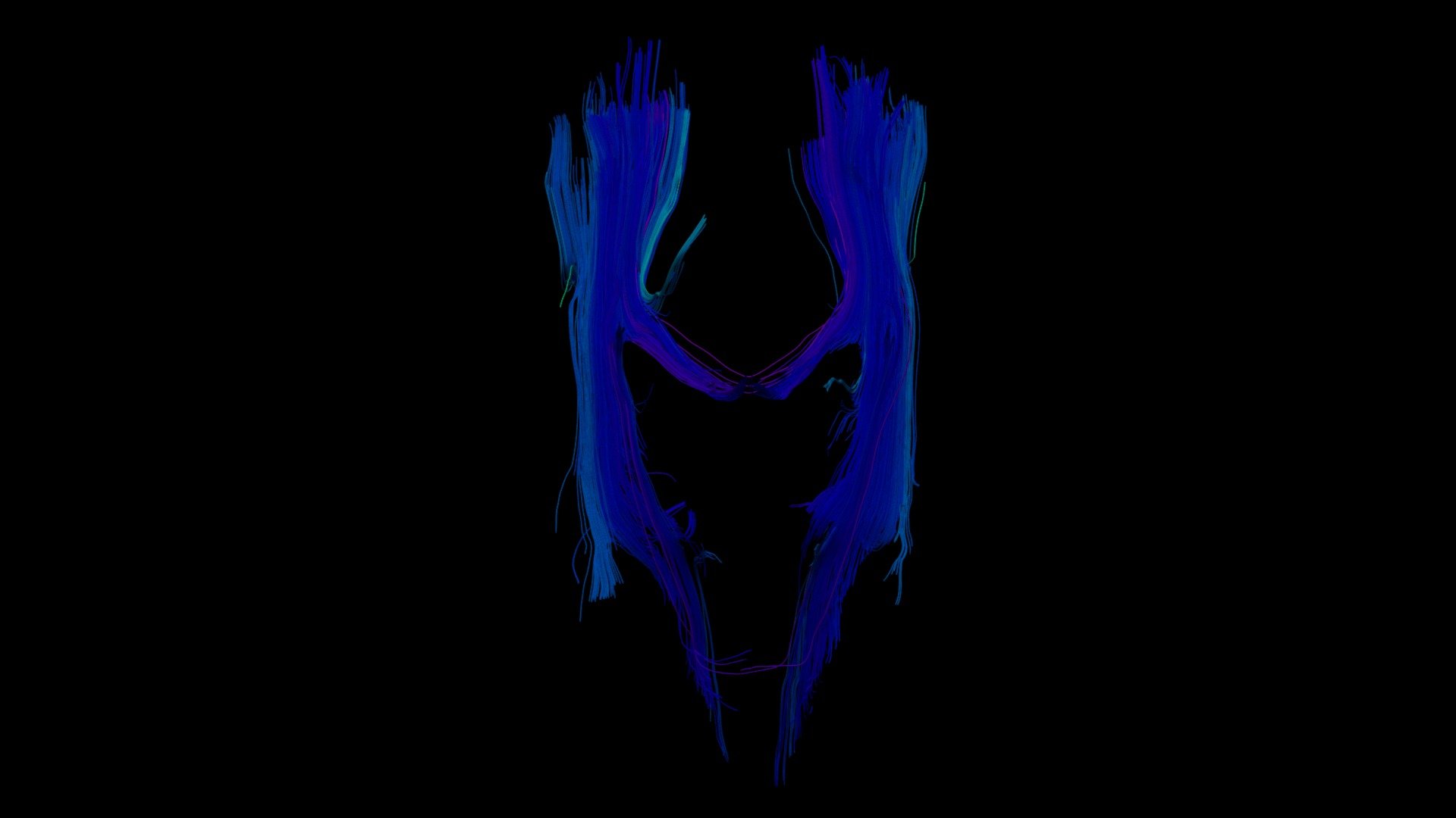 Corona Radiata from Tractography - 3D model by Tecdes SA (@tecdessa ...