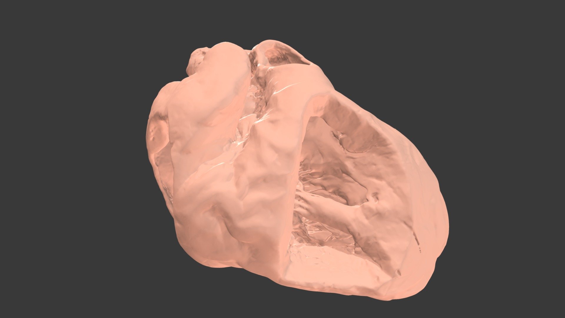 ASD #2 - {S,D,S} with ASD 2, PDA - 3D model by heartmodels [1e66872 ...