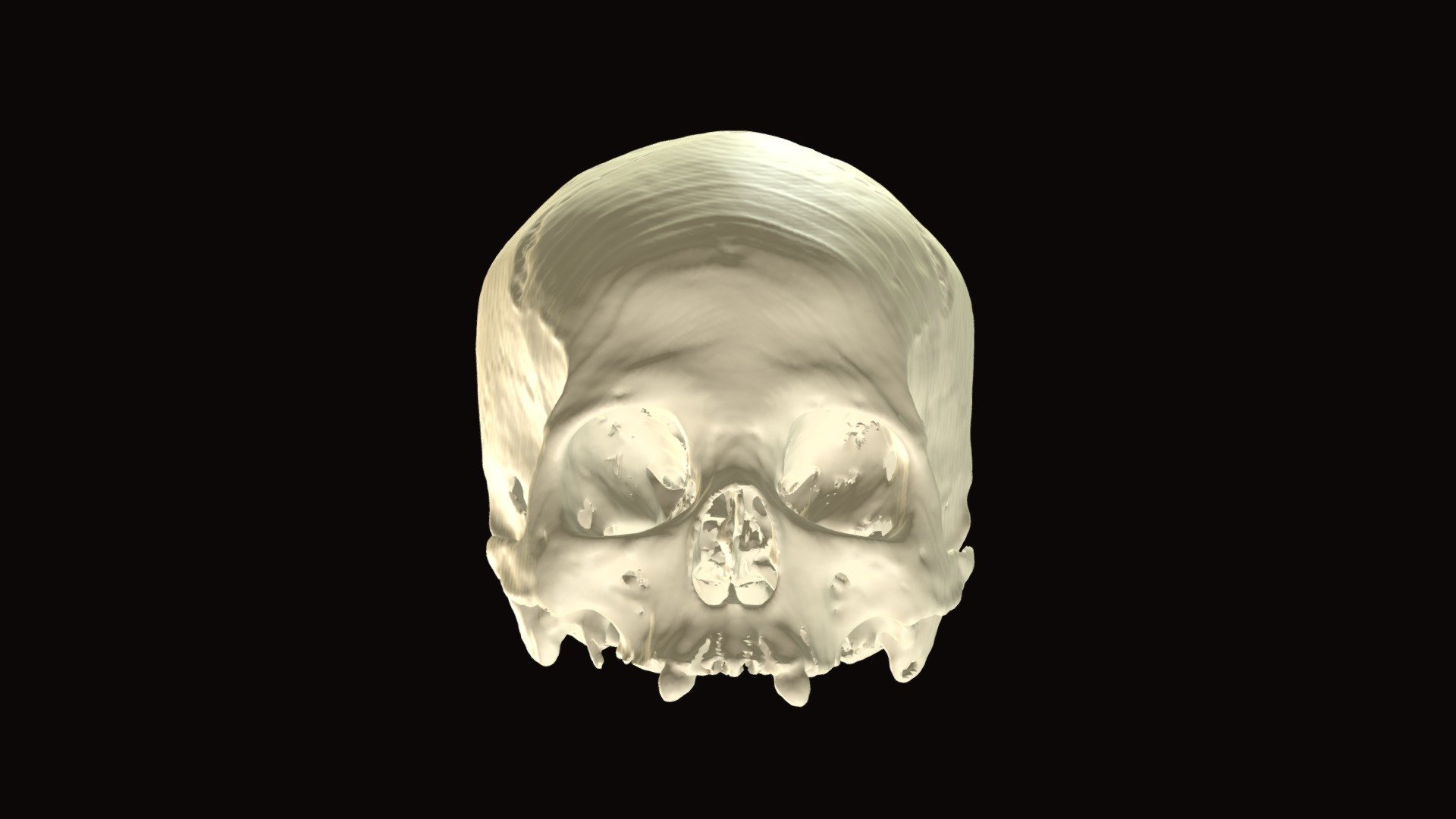 Gunshot wound to a human skull - Download Free 3D model by Pat Randolph ...