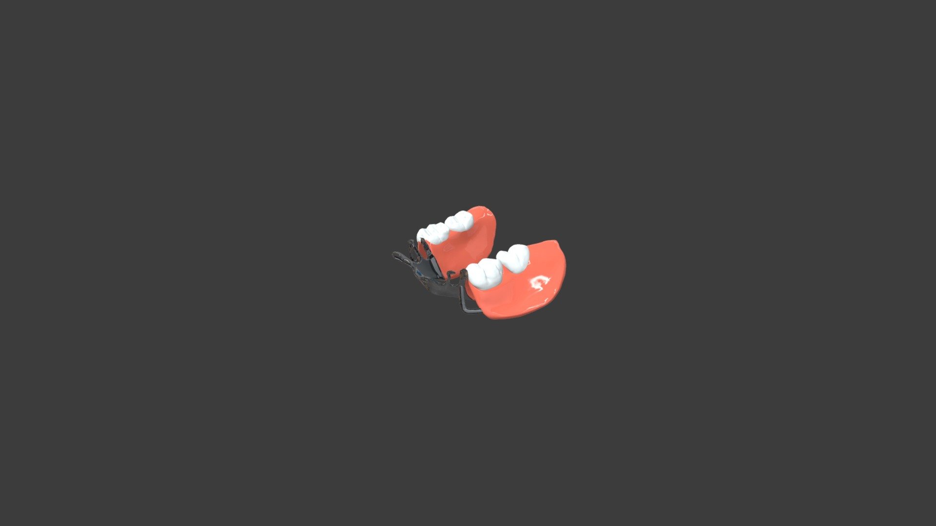 Mandibular RPD - 3D model by Ahmed Mahrous (@drahedmahrous) [1e7f913 ...