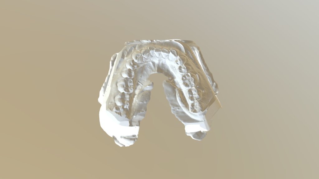Lower Raw Preparation Scan - 3D model by thewhitelab [1ed2610] - Sketchfab