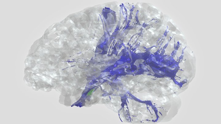 Amygdala 3D models - Sketchfab