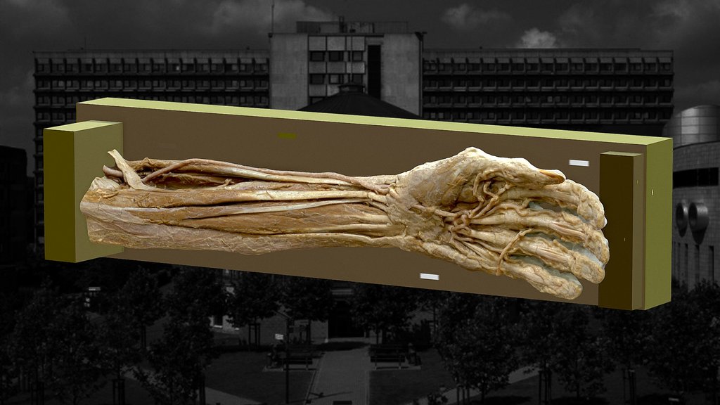 Upper Limb Muscles Nerves Blood Vessels - A 3D model collection by d ...