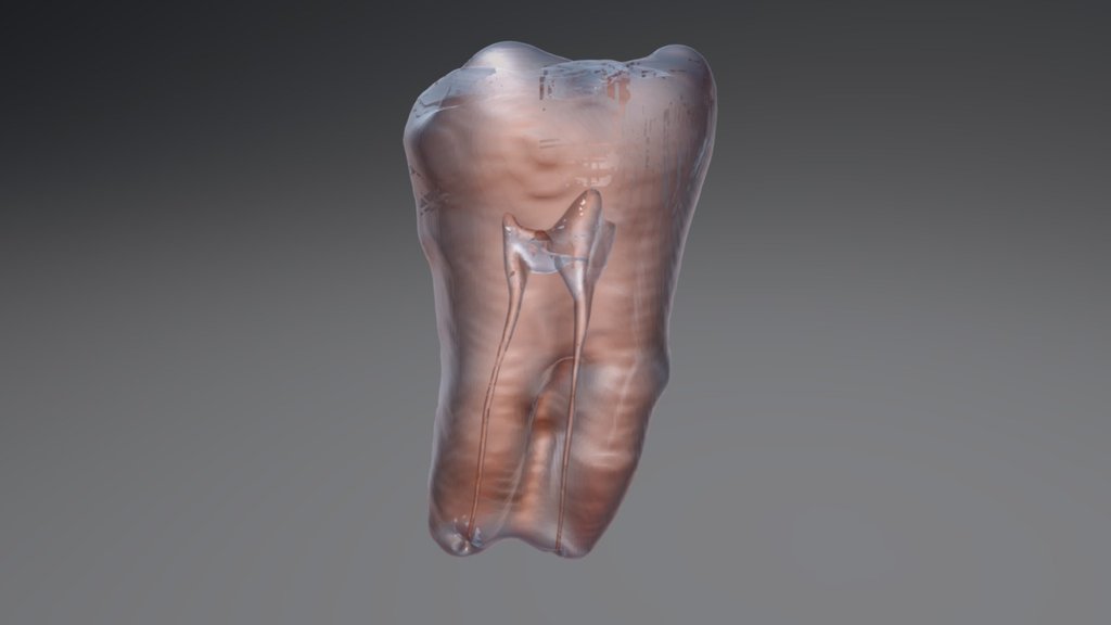 Tooth-5 - 3D model by GeorgeMicroDental [1f4fb2a] - Sketchfab