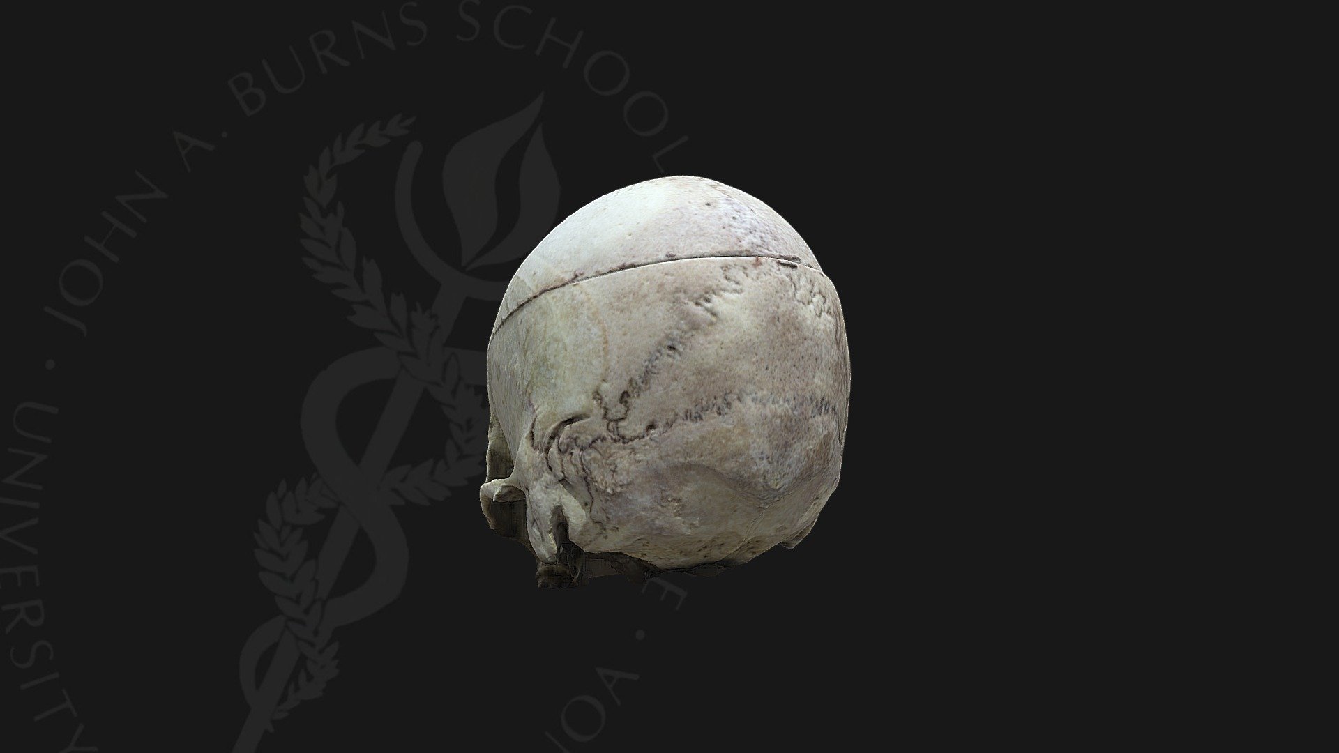 os interparietale - 3D model by John A Burns School of Medicine ...