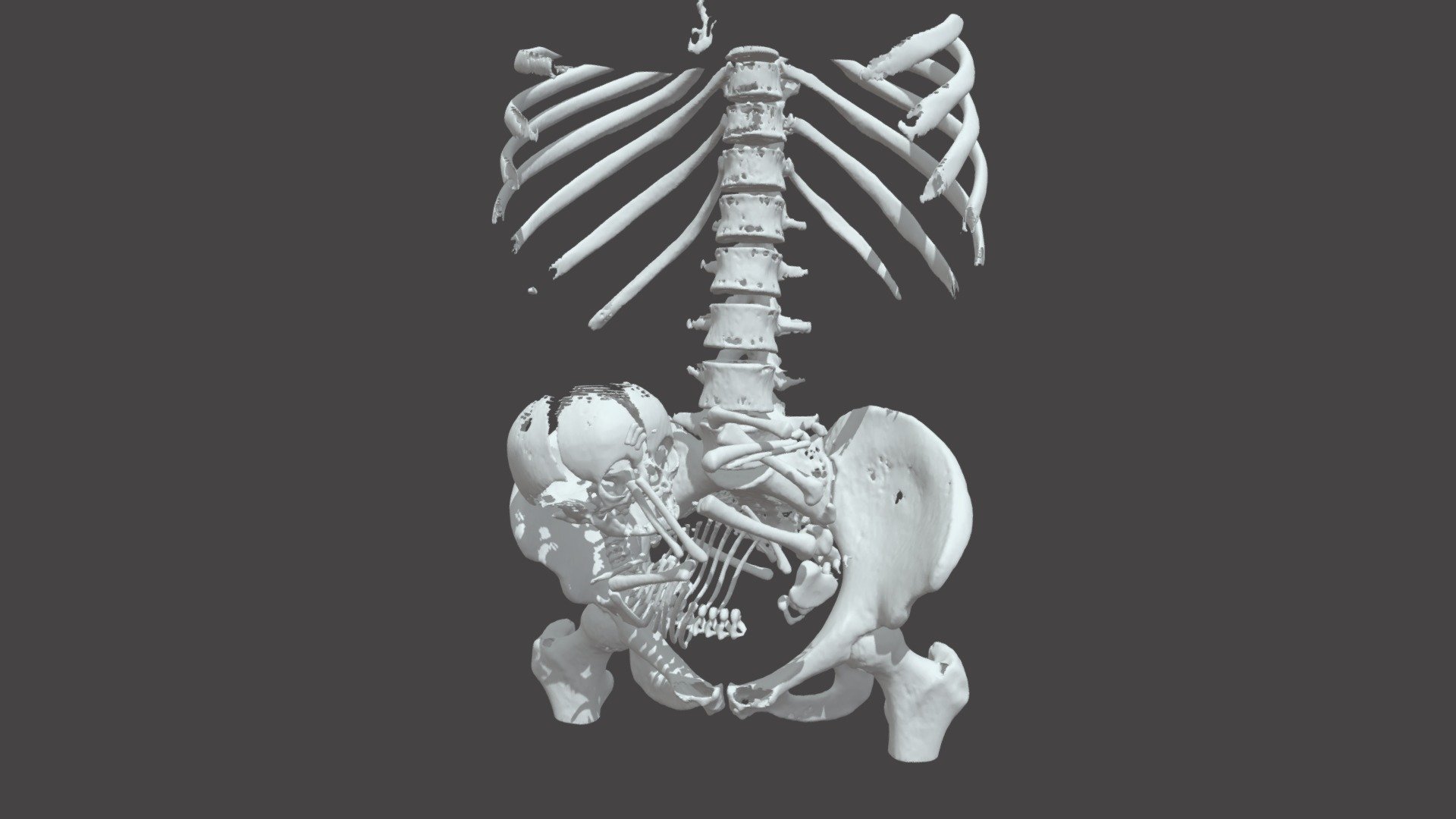 Mother and 38W Fetus - 3D model by ajdon [1f79fc9] - Sketchfab