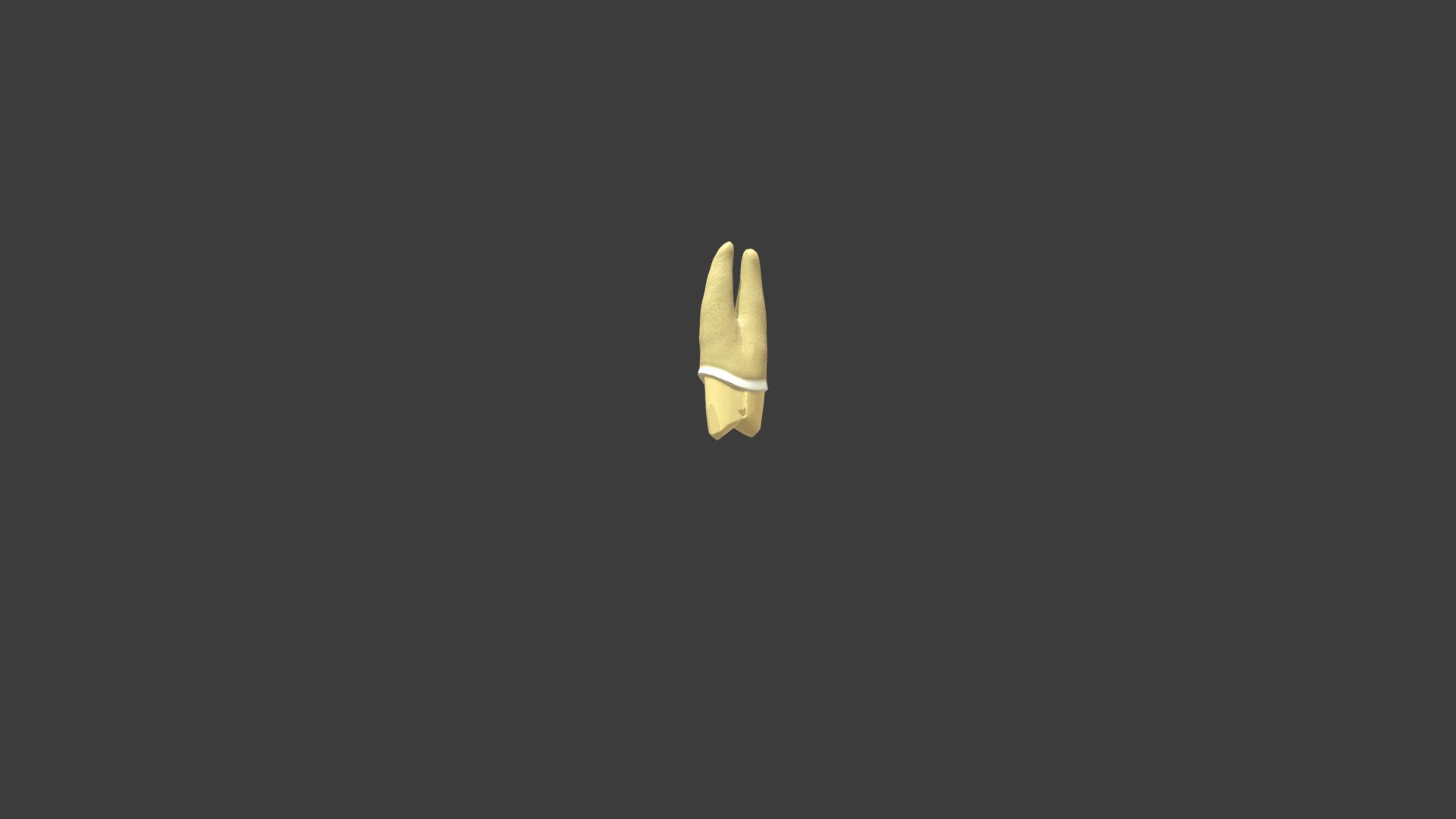 Premolar PFM Crown Prep - 3D model by Ahmed Mahrous (@drahedmahrous ...