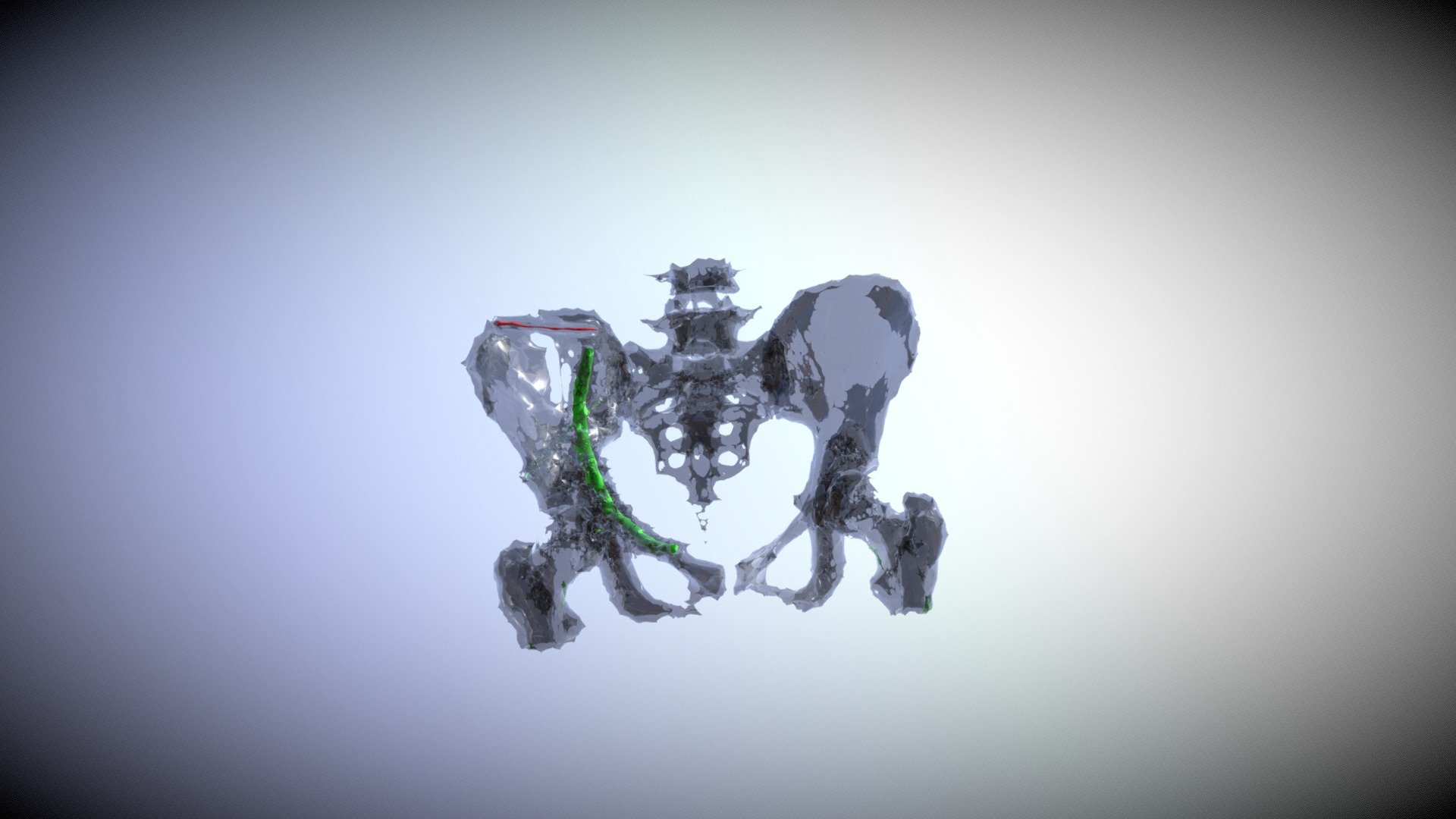 Sweeney_Segmentation - 3D model by Shannon.Sweeney [2053654] - Sketchfab