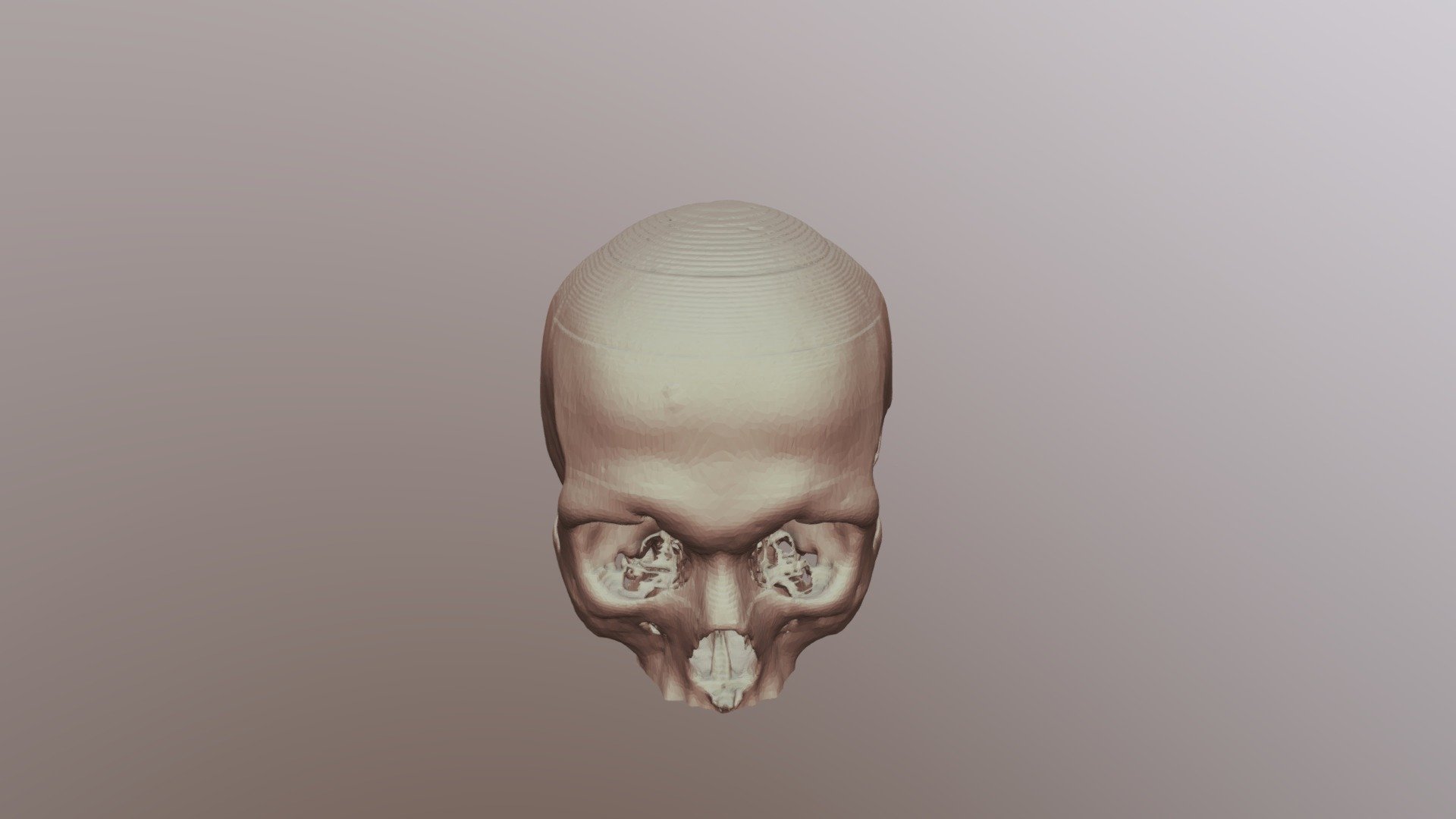 Cranio Sfondato - 3D model by davz1977 [2055a80] - Sketchfab
