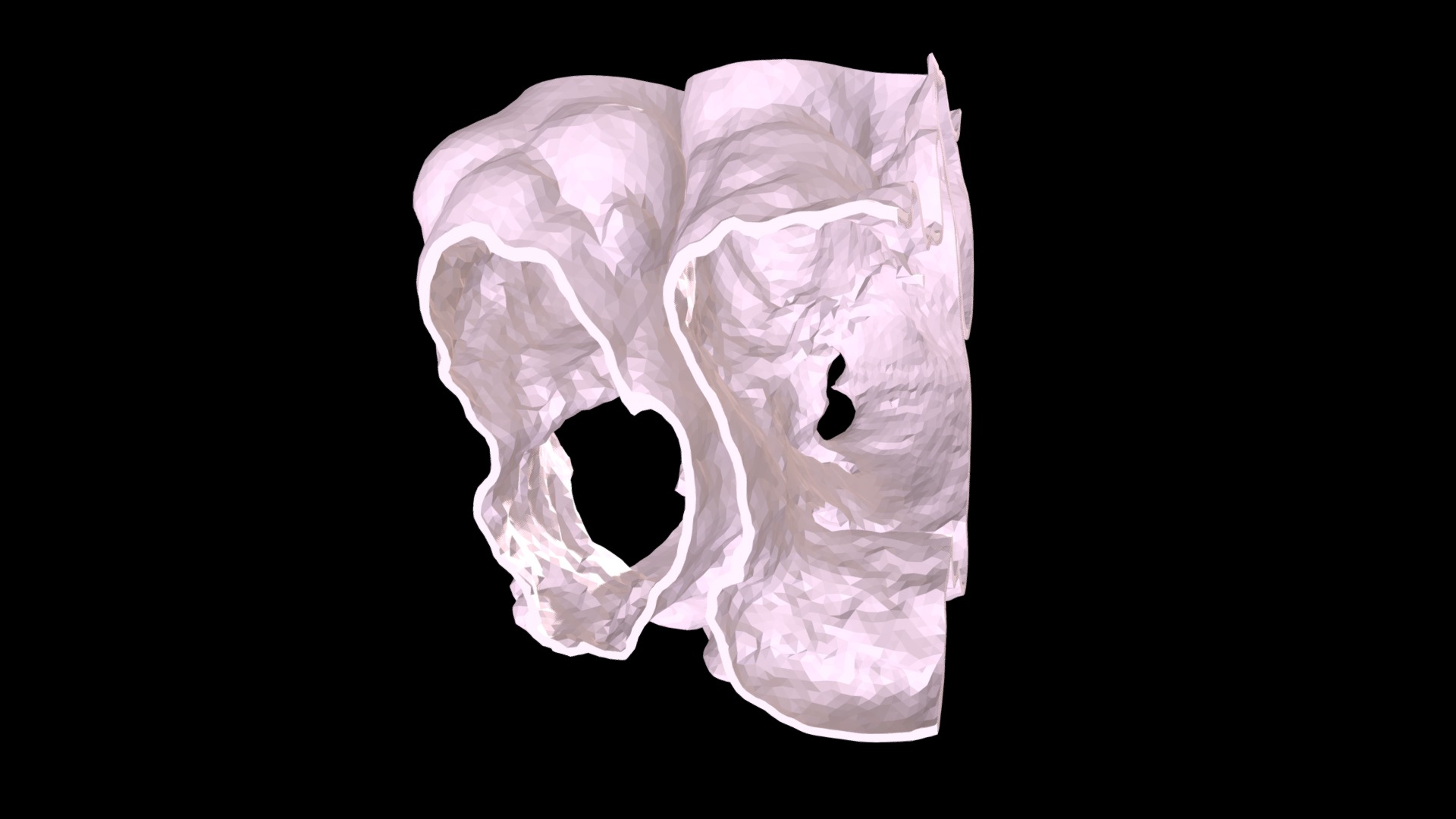 Presurgical Heart - Baffle Leak - Download Free 3D model by APIL (@apil ...