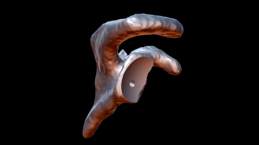 # 023 Scapula Replacement - 3D model by makerof3d [2085a1e] - Sketchfab