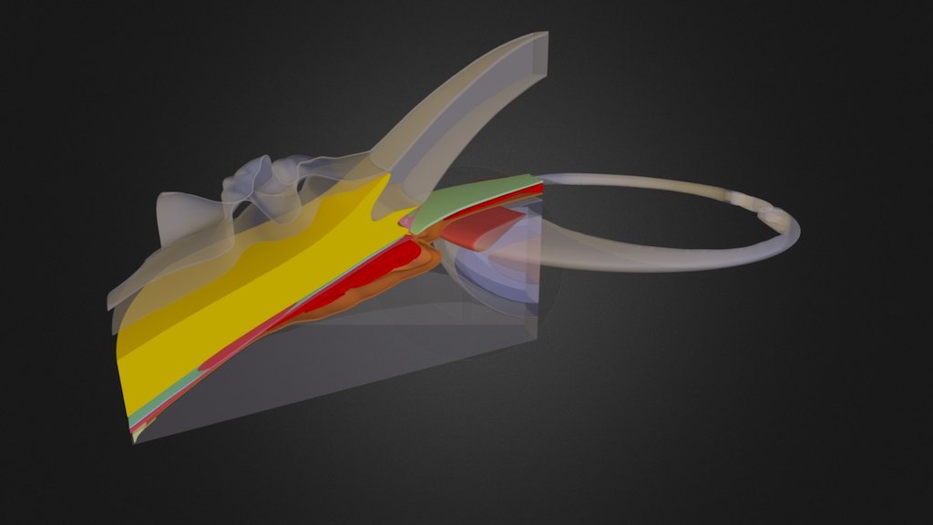 IOP sensor soported on the sulcus - 3D model by iogs oftalmologia ...