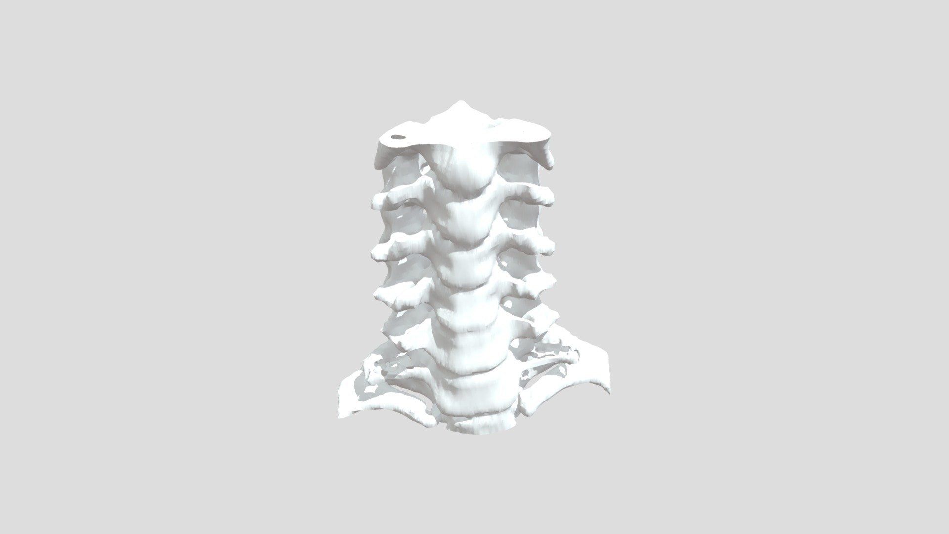 Cervical spine bone model 1 - Download Free 3D model by neurospine3d ...