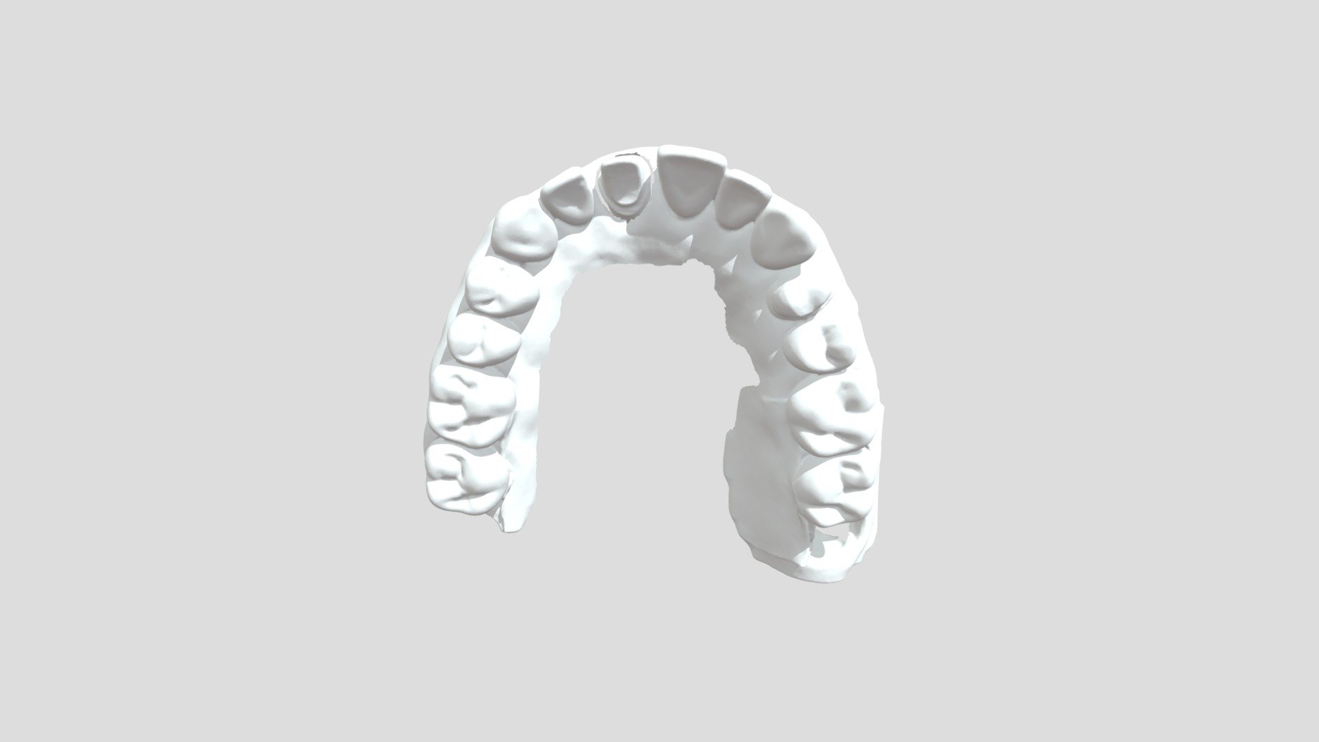 Upper Preparation Scan - 3D model by mendoncad [21c12e5] - Sketchfab