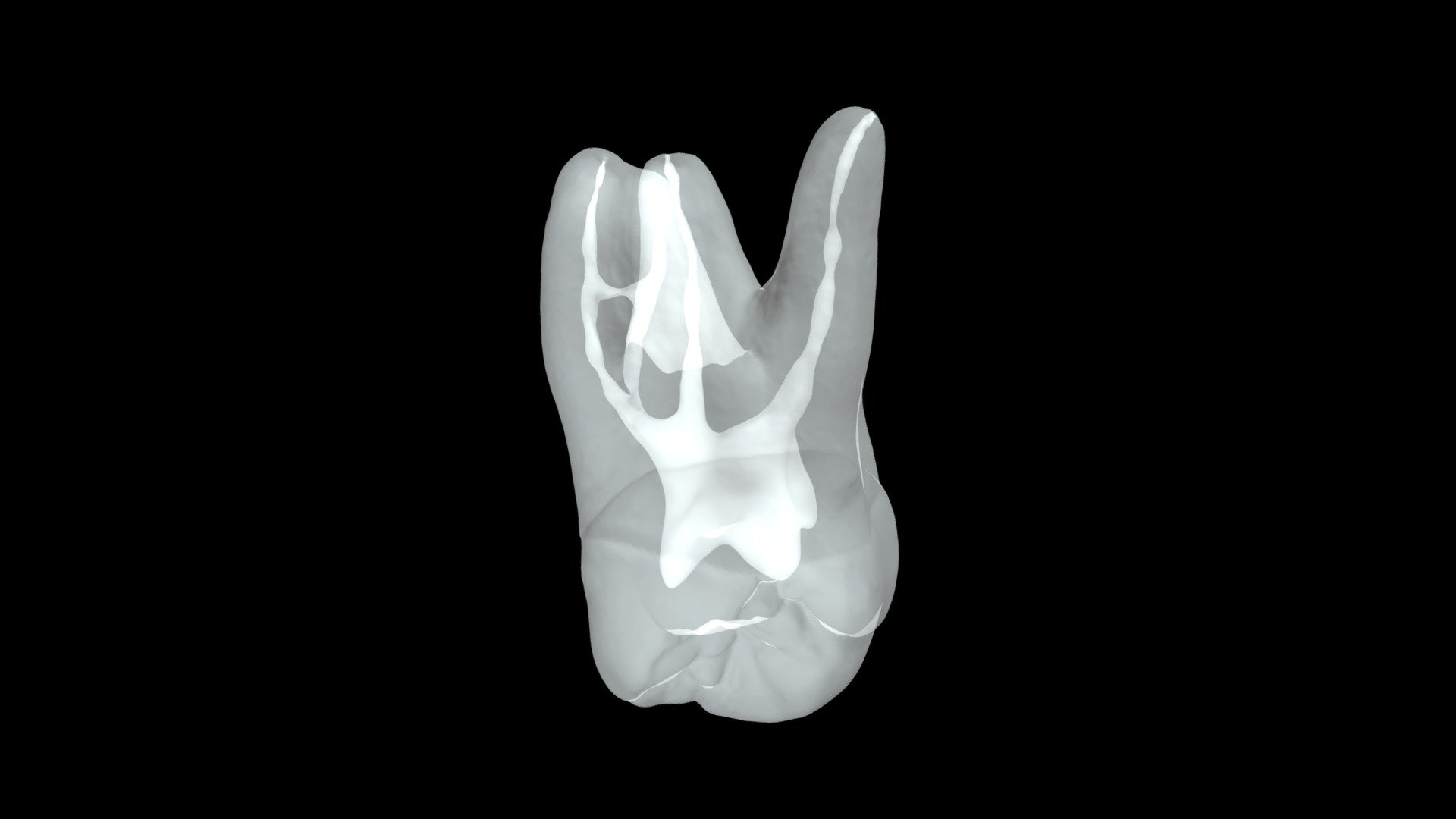 Tooth 14 - 3D model by biomed3d [21f31bf] - Sketchfab