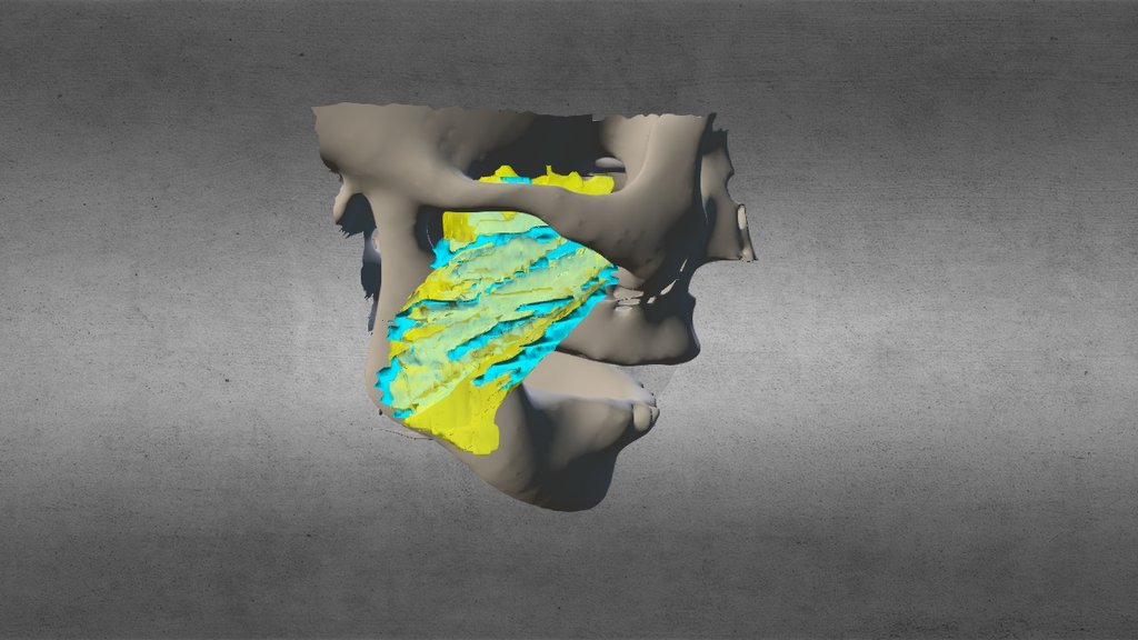 Masseter and its muscle fiber - 3D model by sdssoft [221df79] - Sketchfab