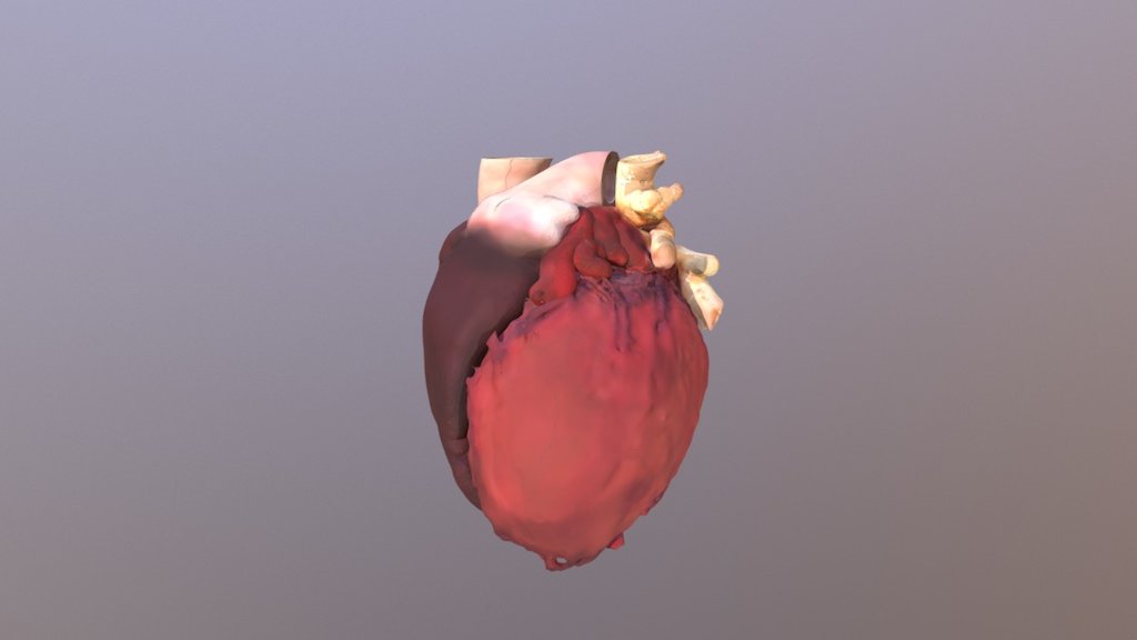 heart - A 3D model collection by bfnnfjjj1149988 - Sketchfab