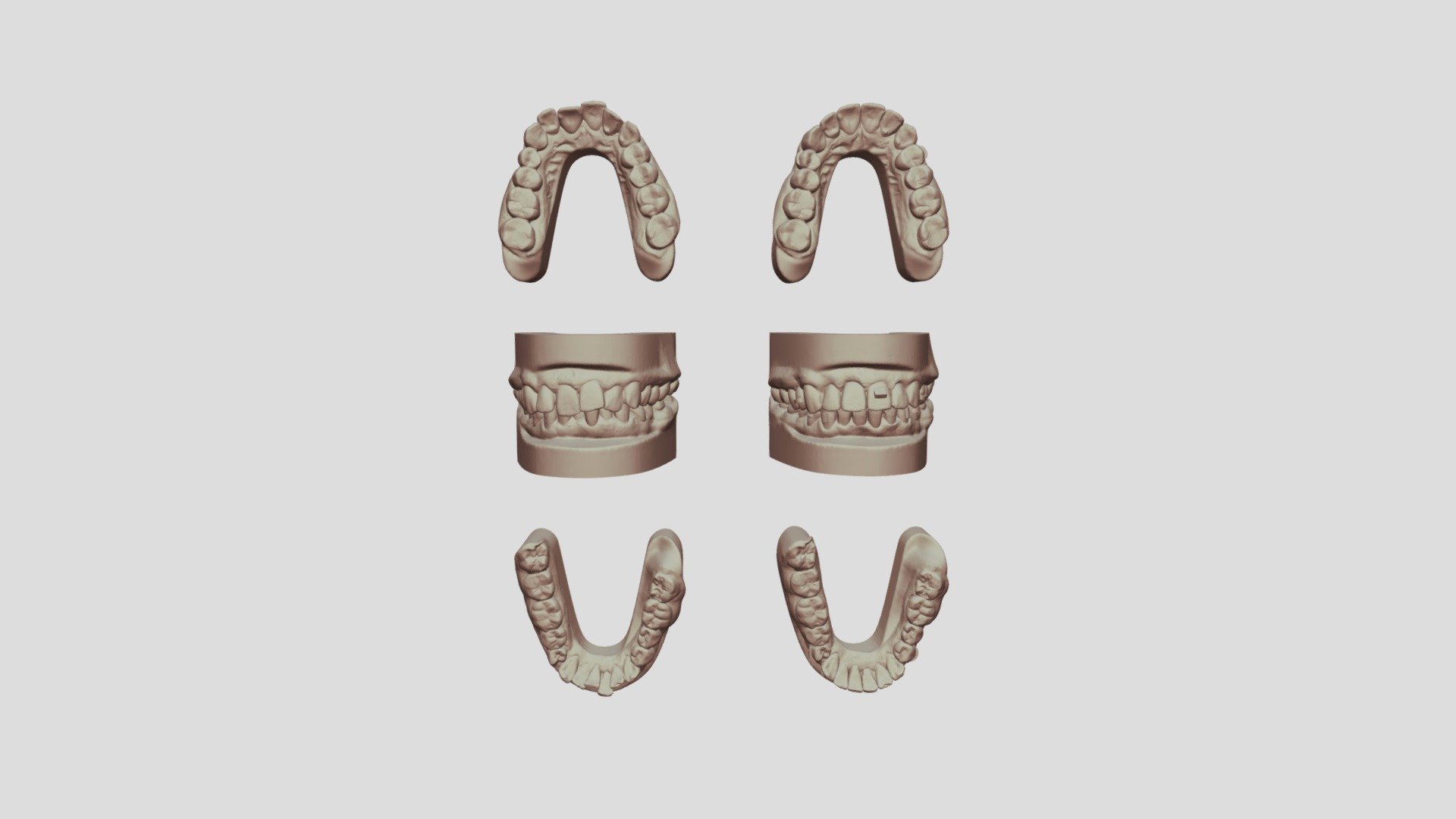 DM - 3D model by vincentuzegeortho [22d1f0f] - Sketchfab