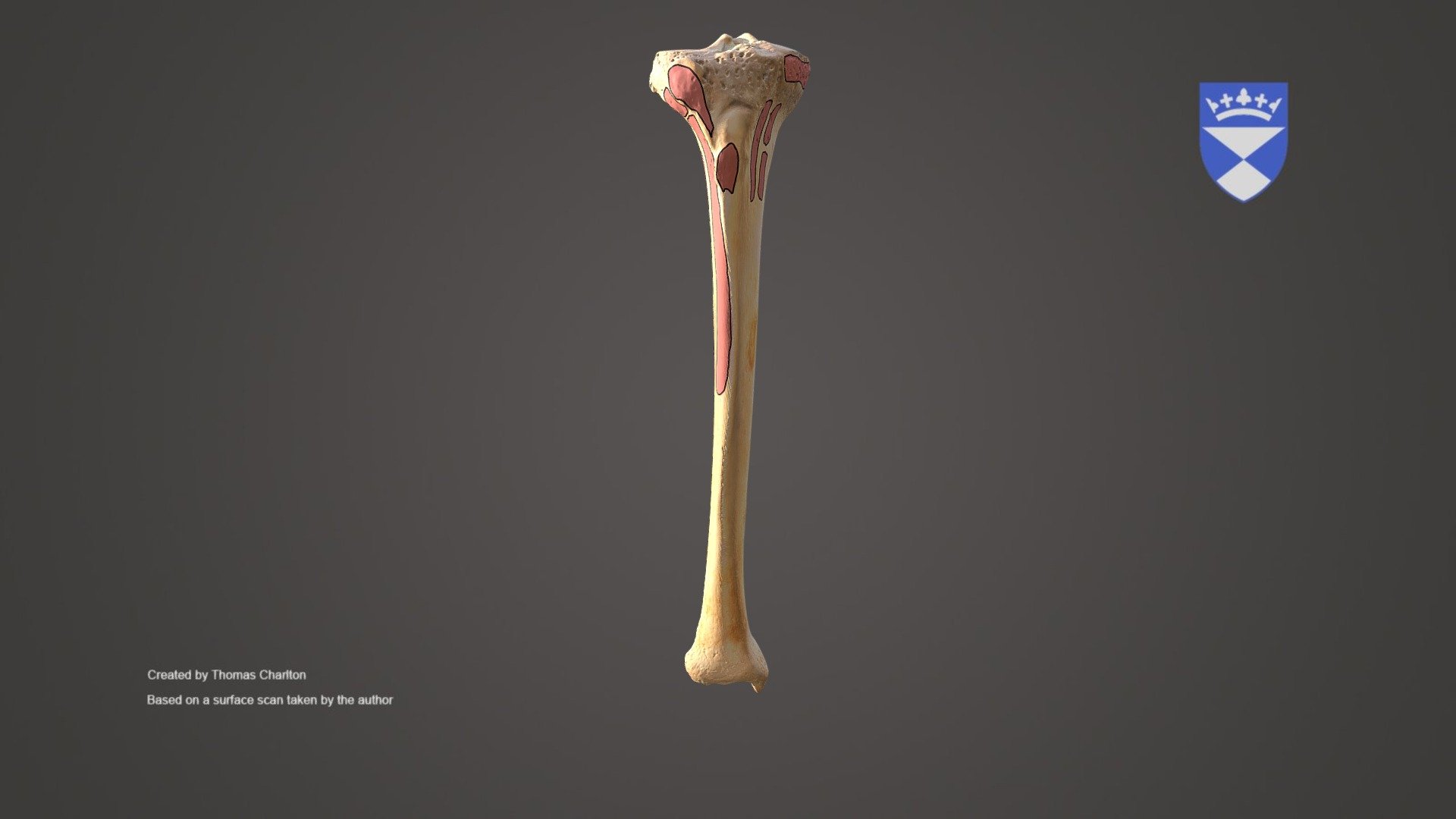 Tibia with muscle markings - 3D model by University of Dundee, CAHID ...