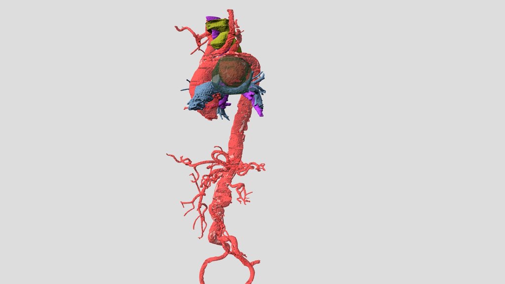 Aorta - A 3D model collection by Antonio J Barros Membrilla ...
