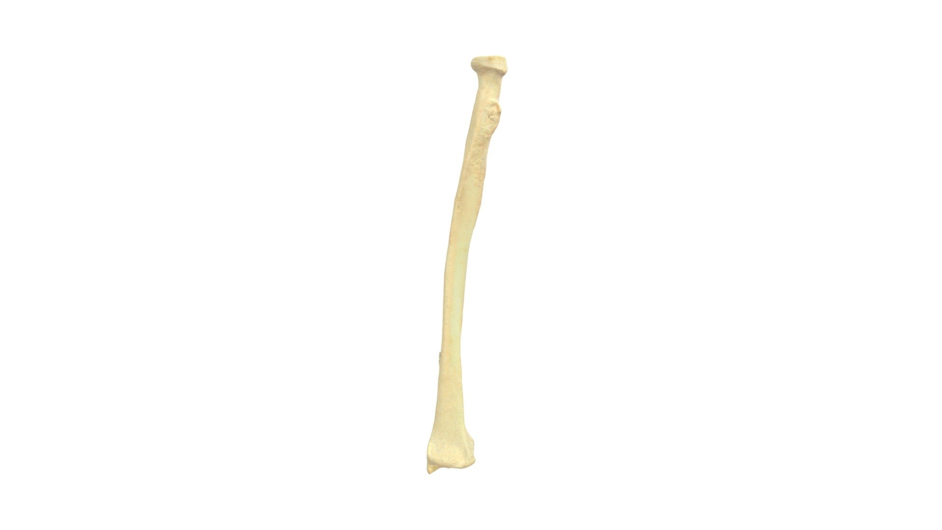 Radius R - Proximale epifyse - 3D model by Universiteit Antwerpen ...
