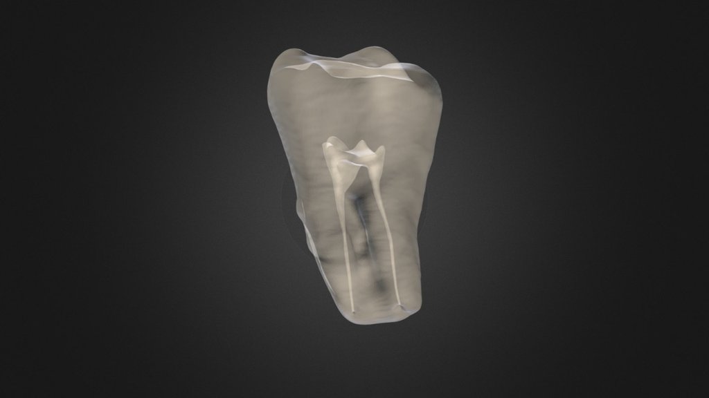 Tooth #1 - 3D model by 3DPMRC [23f1d0e] - Sketchfab