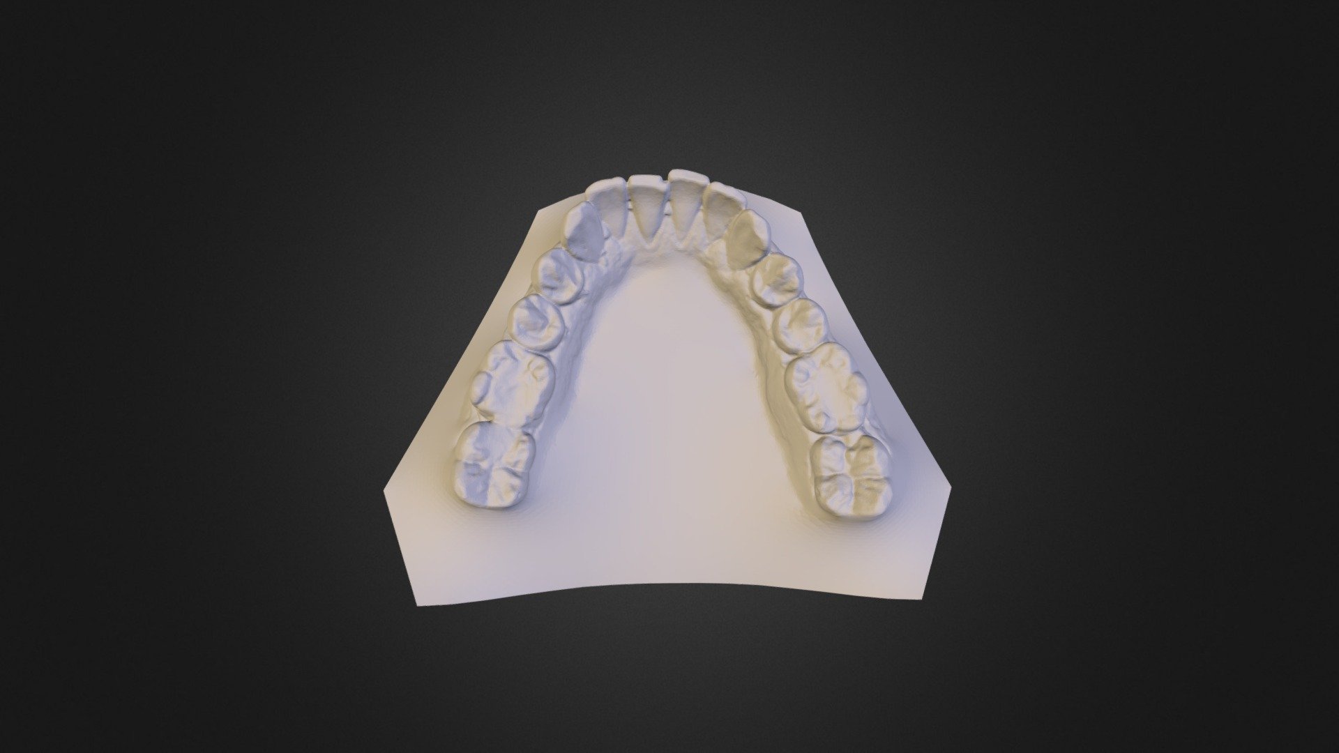Mandibular1.stl - 3D model by roe.radiologia [2462adb] - Sketchfab