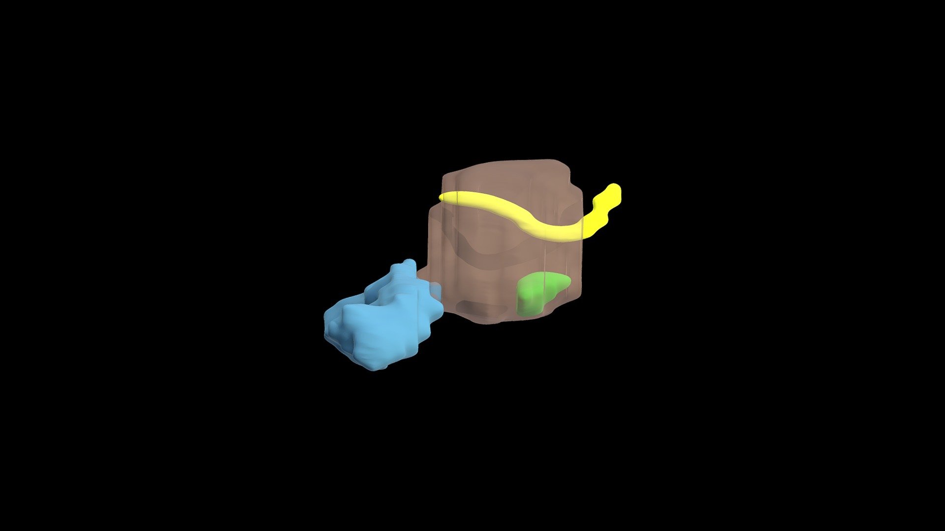 PIRADS4 ZPD apical - 3D model by Cirurgic3D (@neorenal) [24d51bf ...