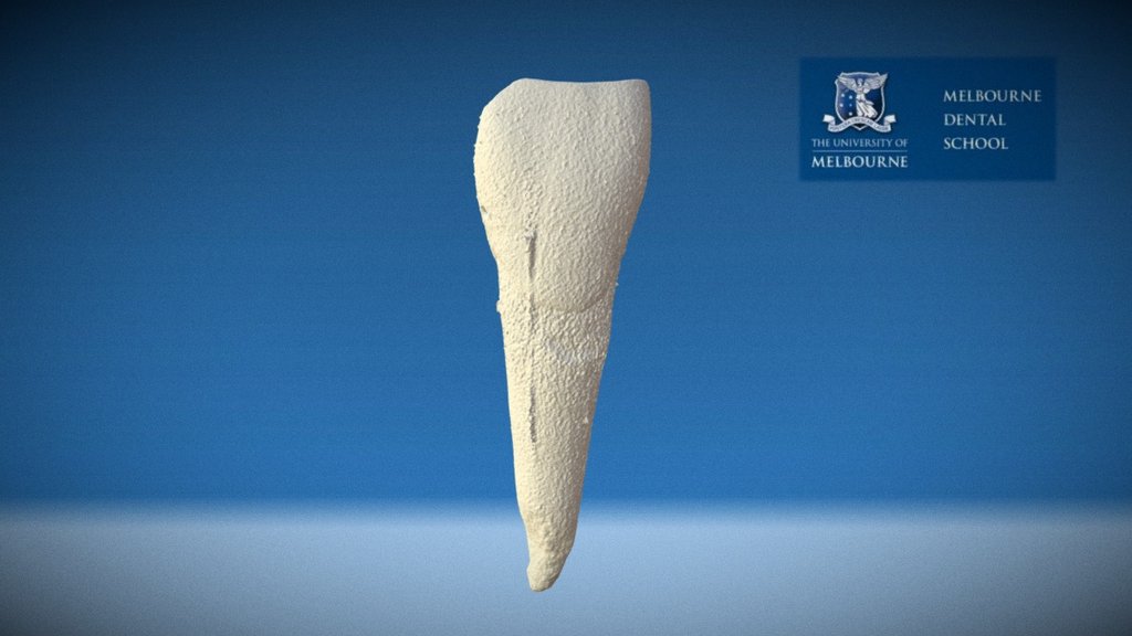 Lower permanent incisor - 3D model by Melbourne Dental School ...